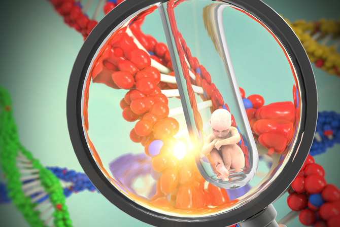 Spinal Muscular Atrophy in Children & the role of IVF and ...